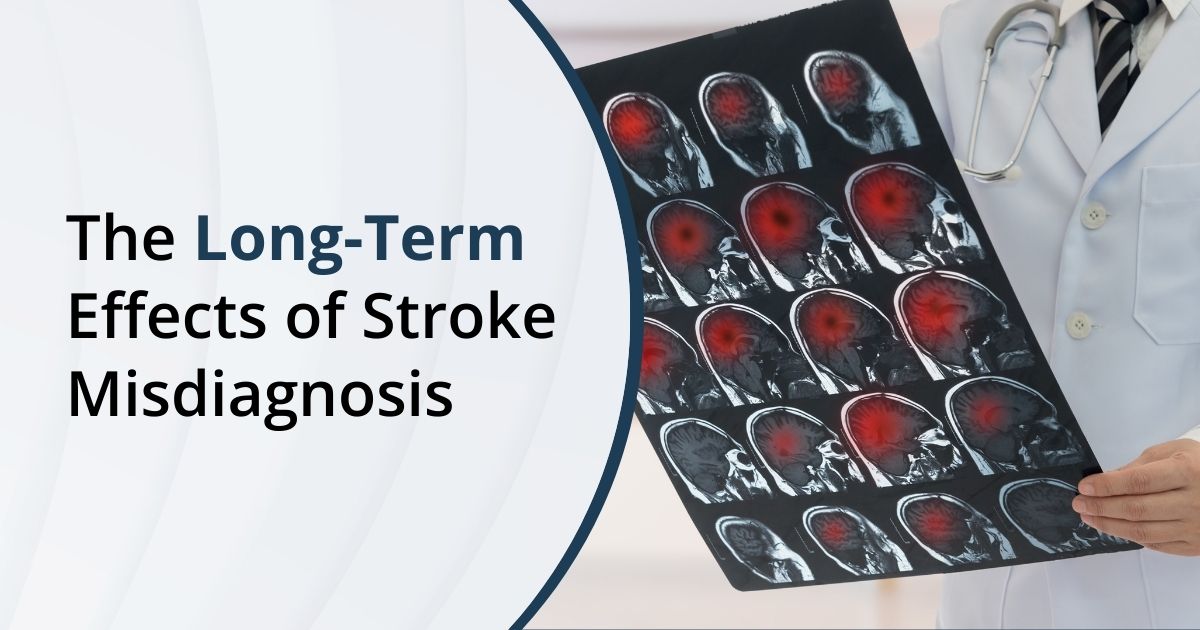 The Long-Term Effects of Stroke Misdiagnosis